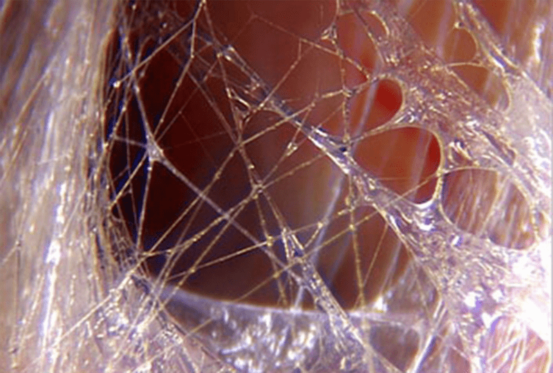 Fascia - the missing link to human health and well being - MihaPower ...